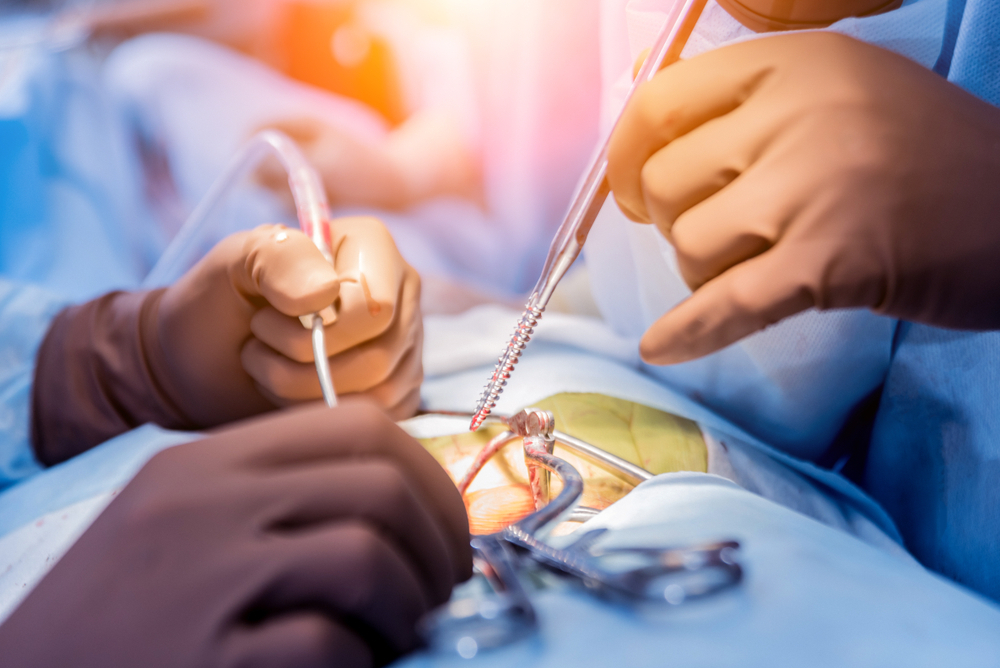 MadrasOrthotraumaCare